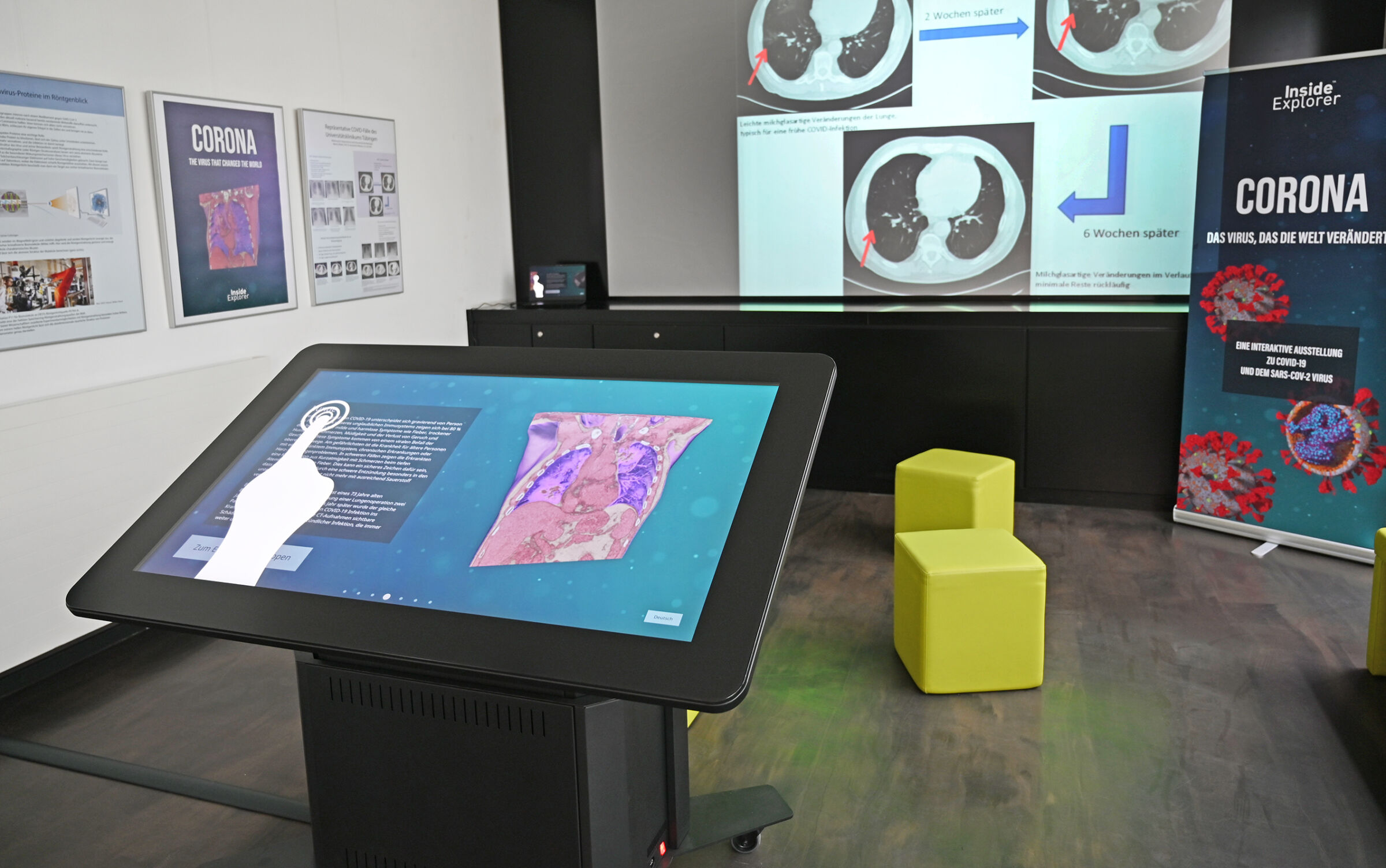 The development of X-ray with Deutsches Röntgen-Museum – Interspectral